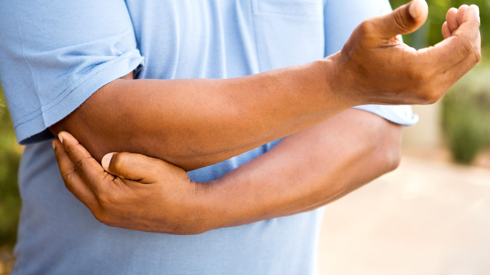 Rheumatoid Arthritis Nodules explained - Connected Rheumatology