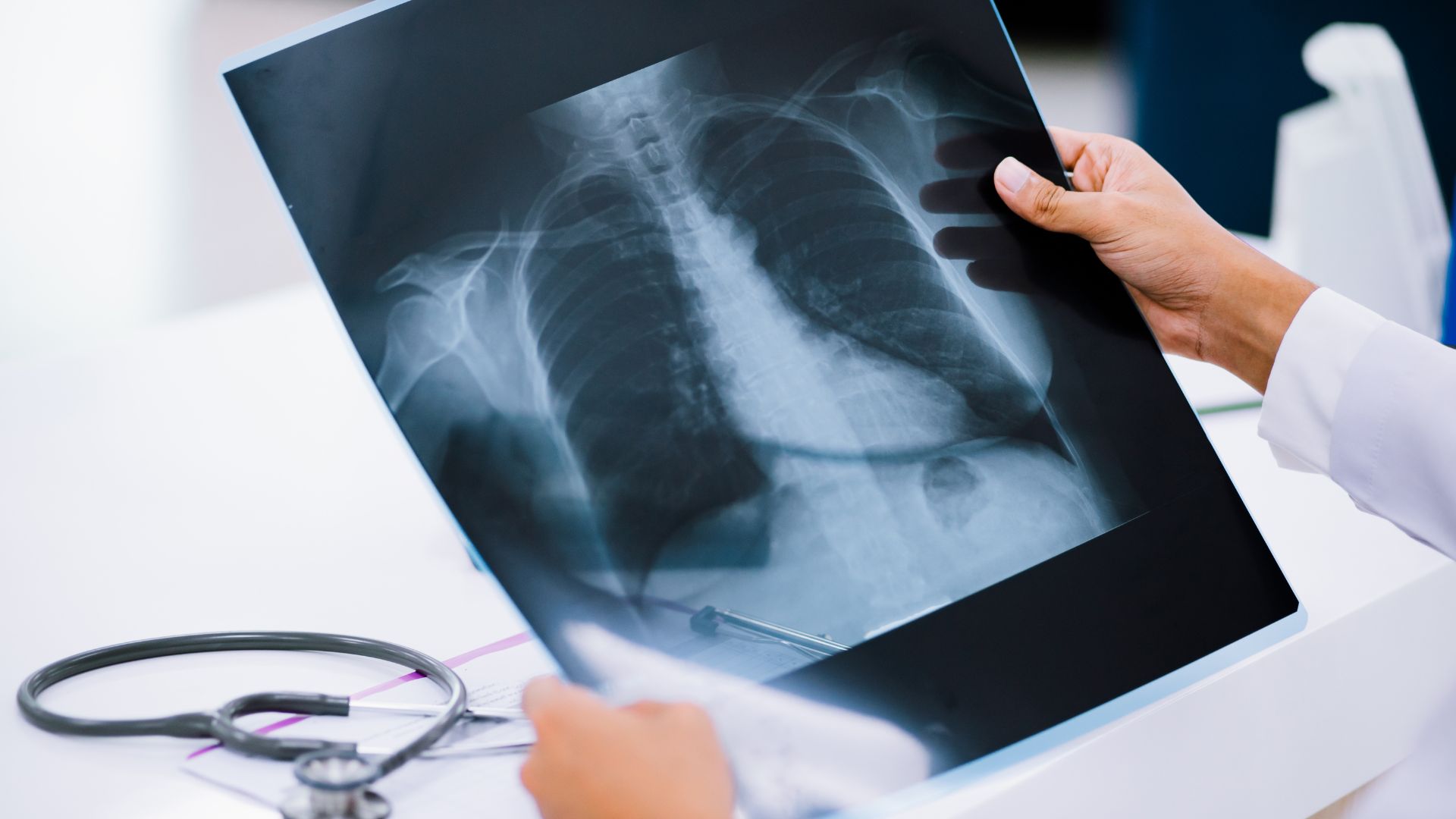 Silent Signs of RA in Your Lungs - Connected Rheumatology